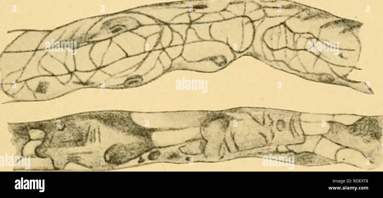 . The effects of inanition and malnutrition upon growth and structure ...