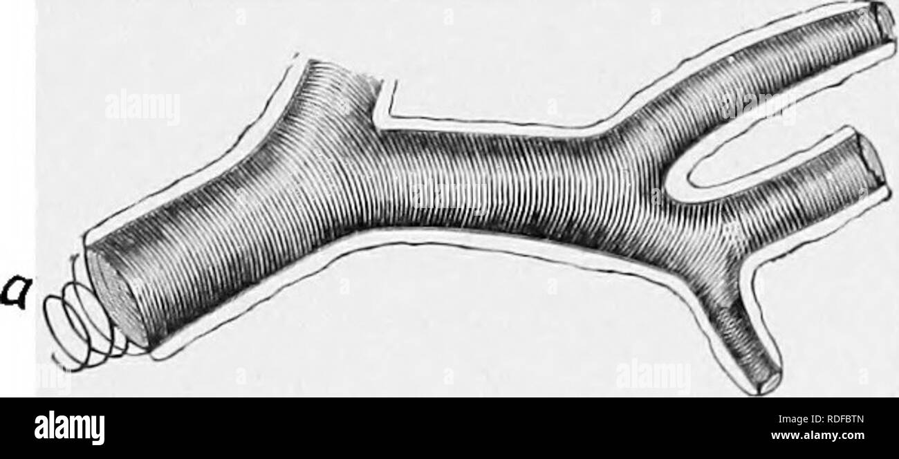 Cartilage rings of the trachea Black and White Stock Photos & Images ...