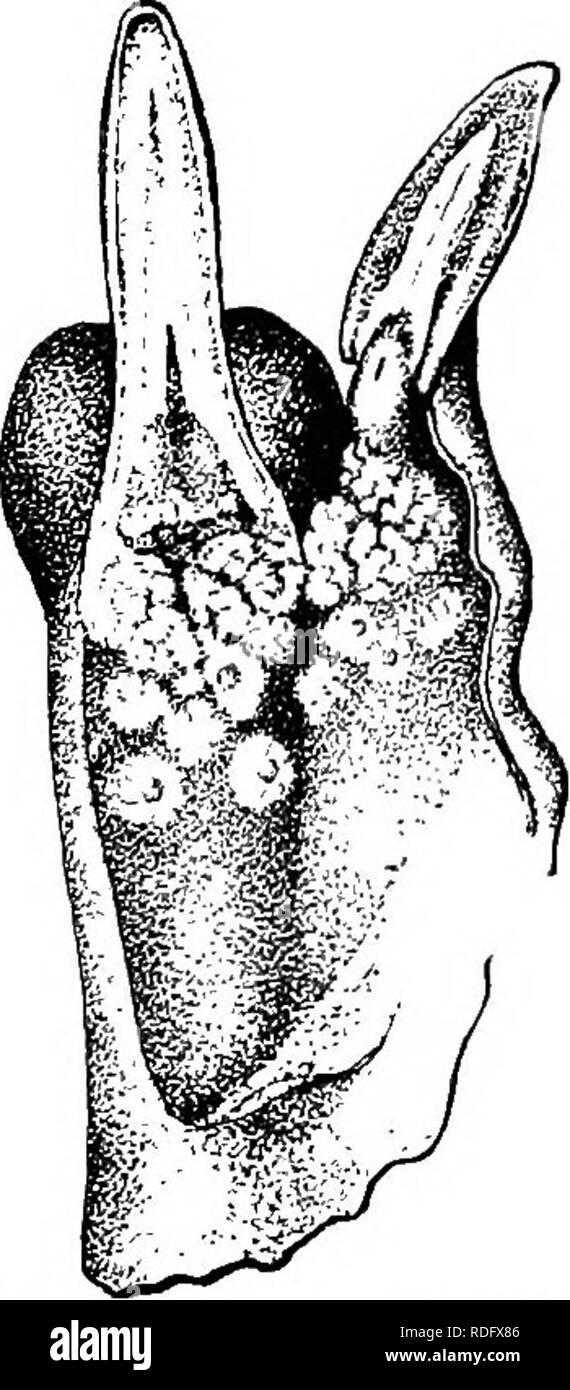 Purulent Exudate High Resolution Stock Photography and Images - Alamy