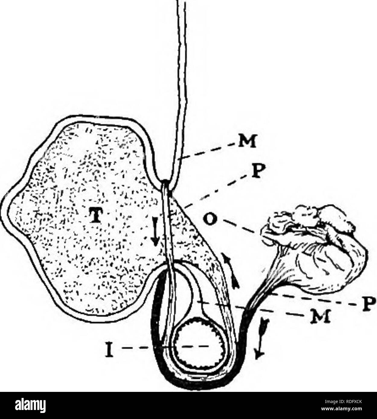 Cornu Uterus