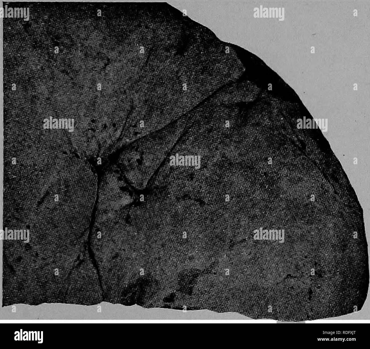 Nocardiosis hi-res stock photography and images - Alamy