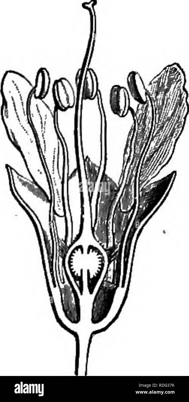 Placenta placement hi-res stock photography and images - Alamy