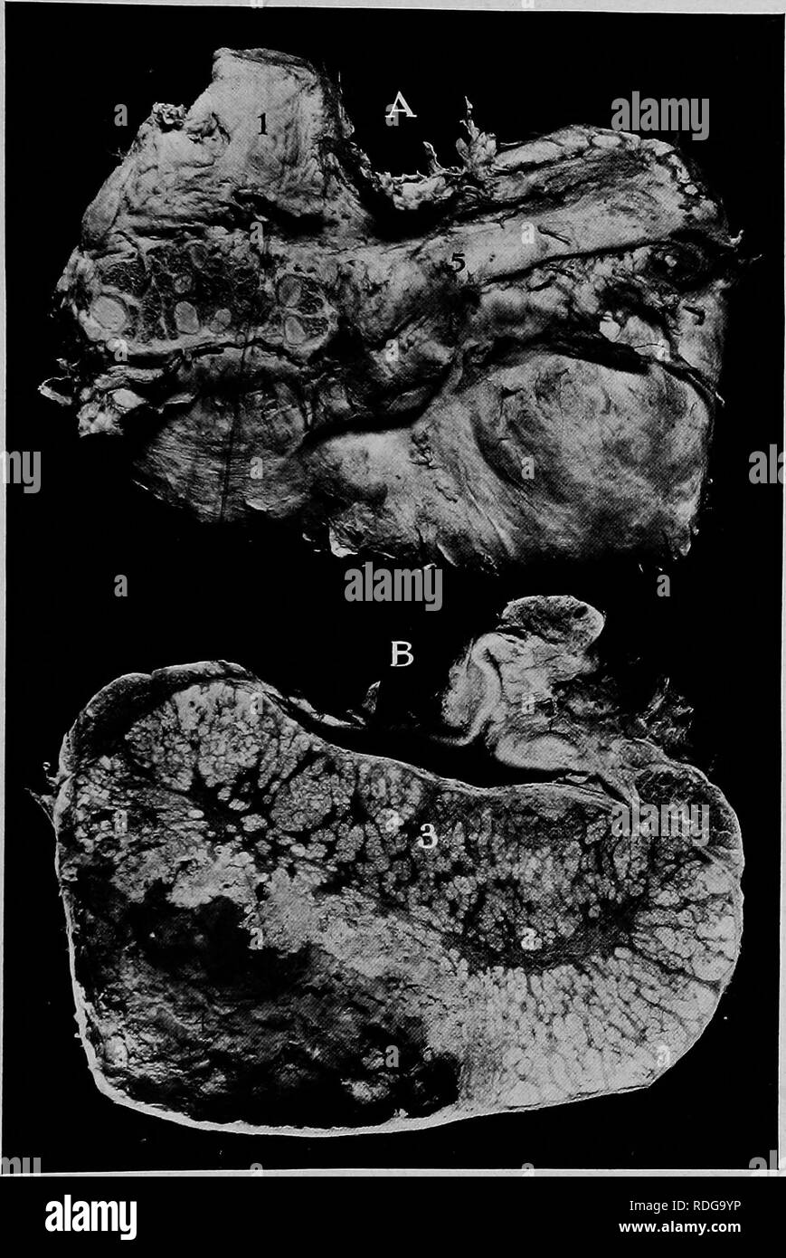 Testis testicle Black and White Stock Photos & Images - Alamy
