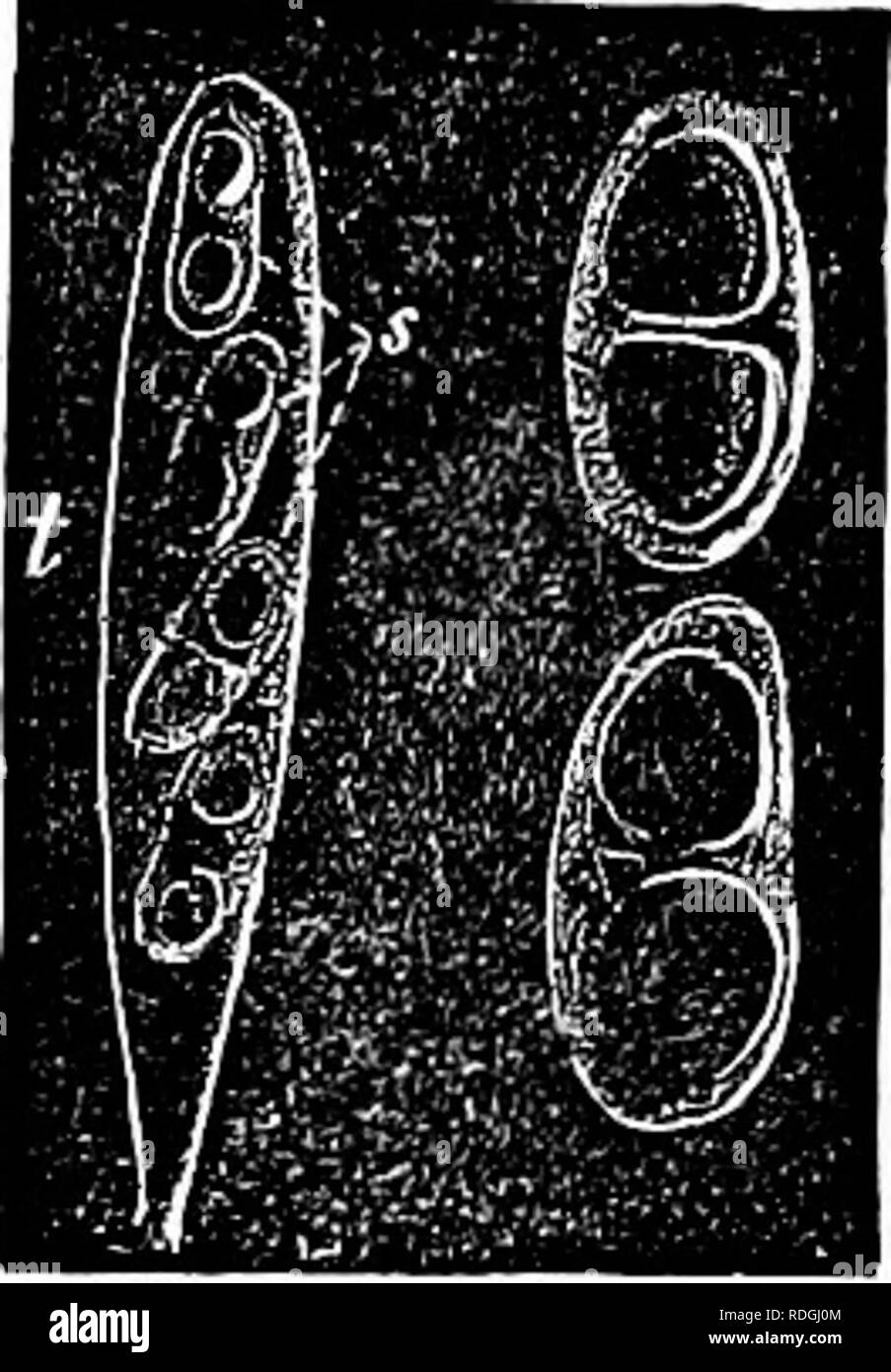 Club shaped stigma hi-res stock photography and images - Alamy
