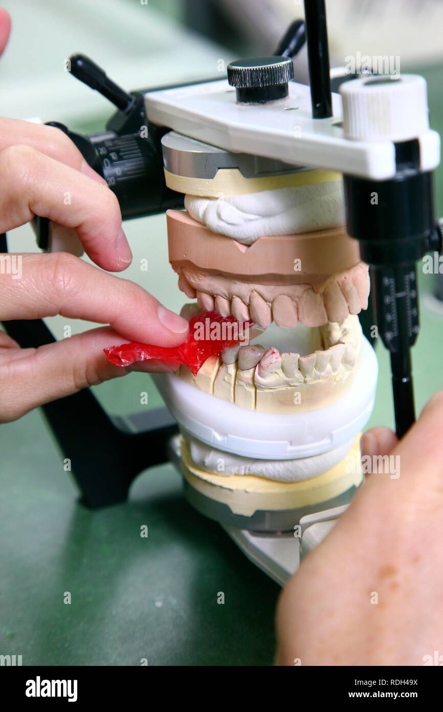 Dental laboratory, manufacture of a dental prosthesis by a master ...