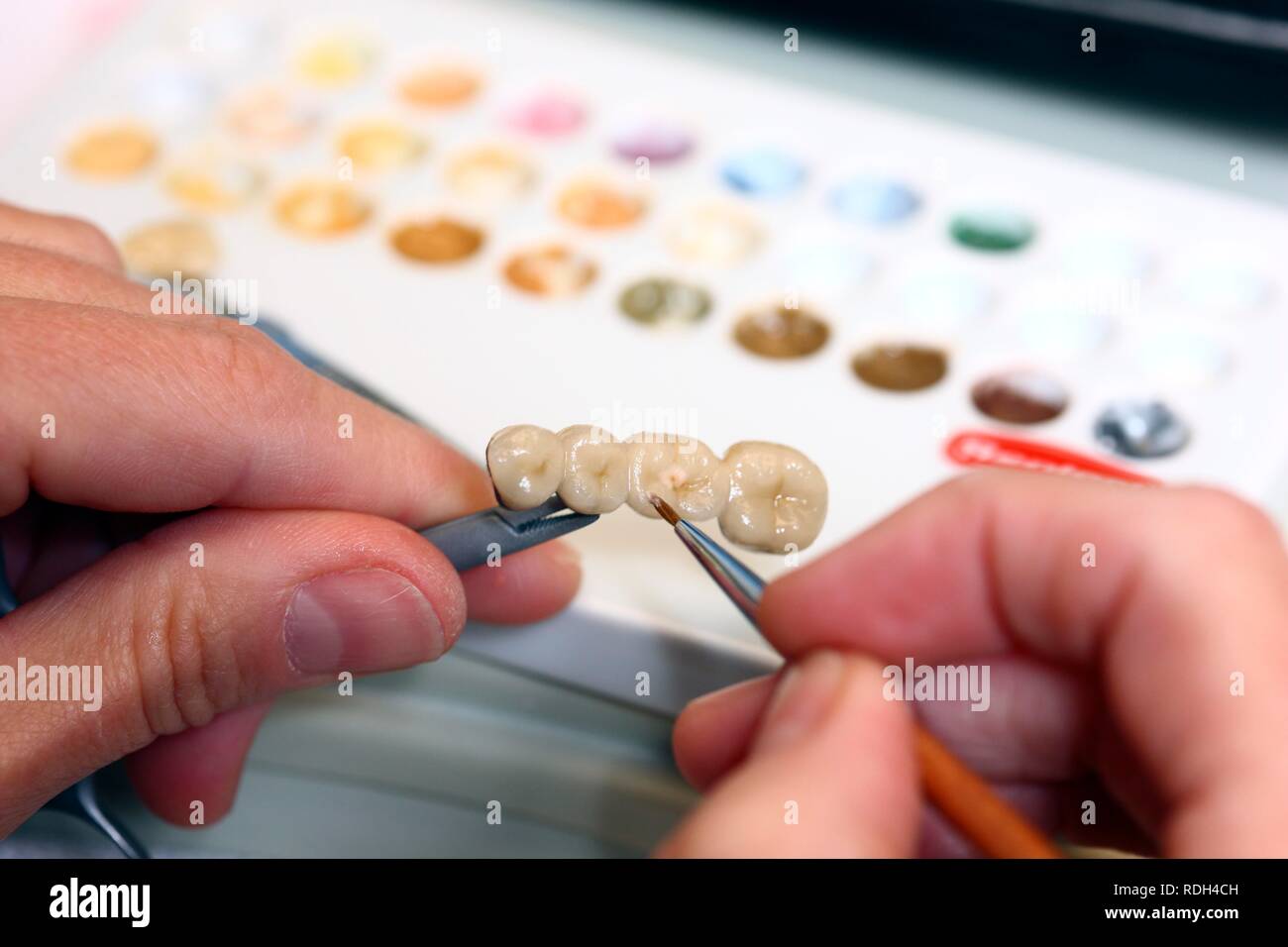 Dental laboratory, manufacture of a dental prostheses by a master ...