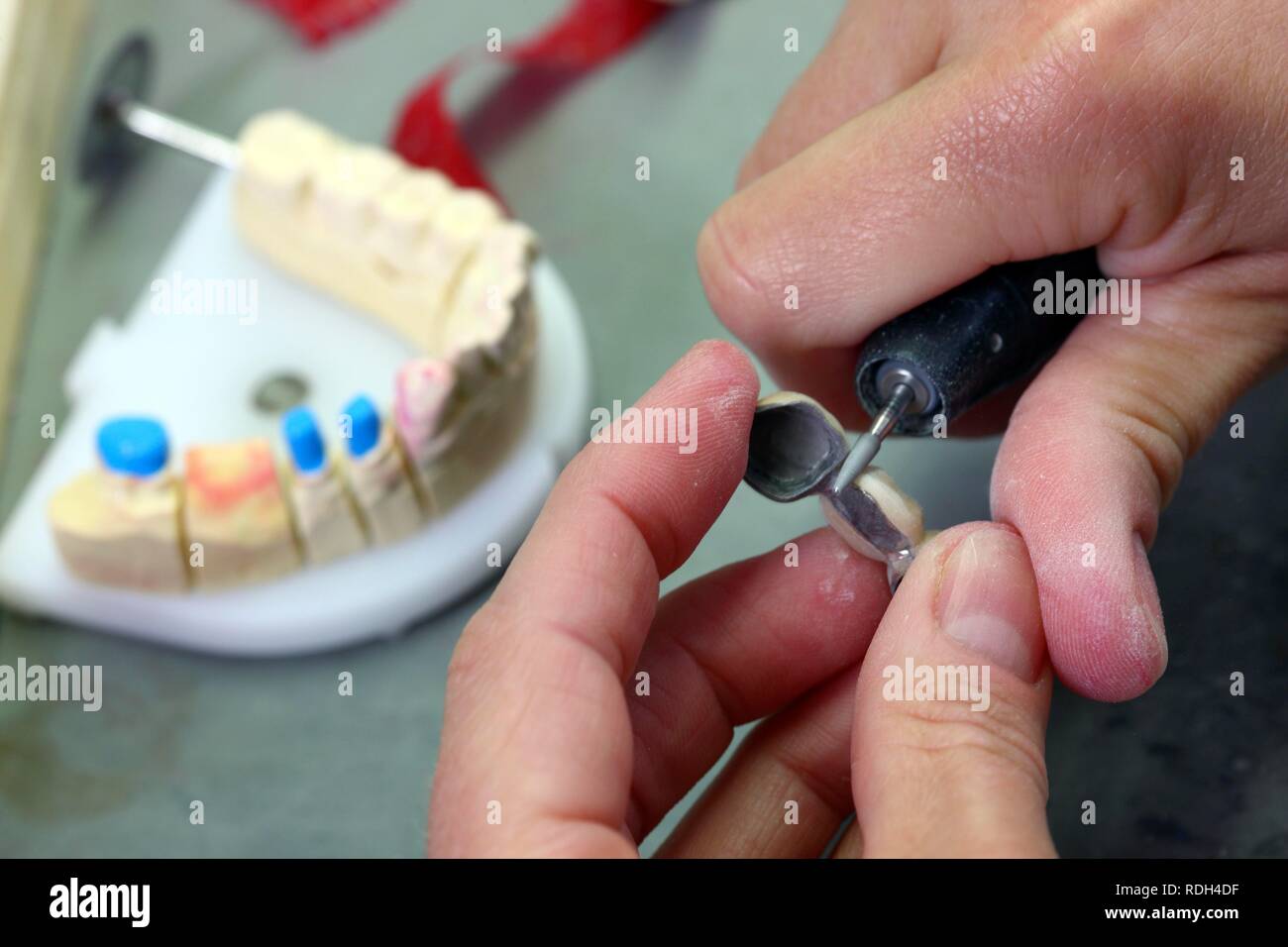 Dental laboratory, manufacture of a dental prosthesis by a master ...