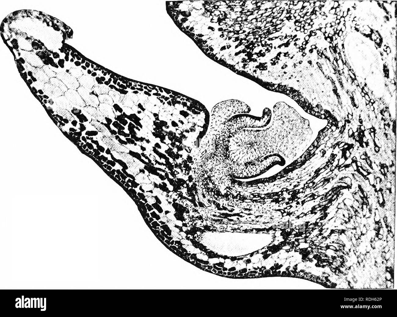 Micropyle In A Conifer
