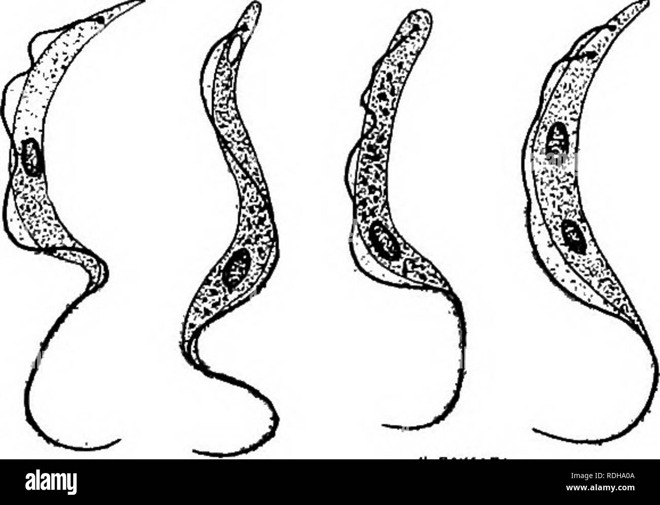 Liver abscess hi-res stock photography and images - Alamy