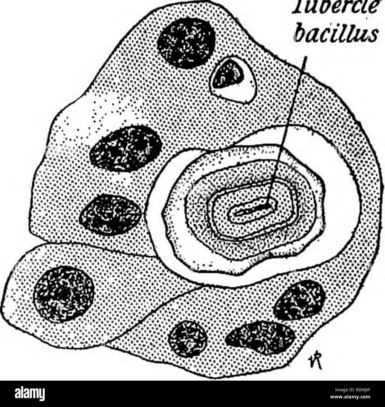 Tubercle Bacillus High Resolution Stock Photography and Images - Alamy