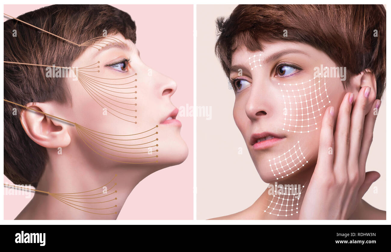 skin plastic surgery concept. Woman face with marks and arrows Stock ...