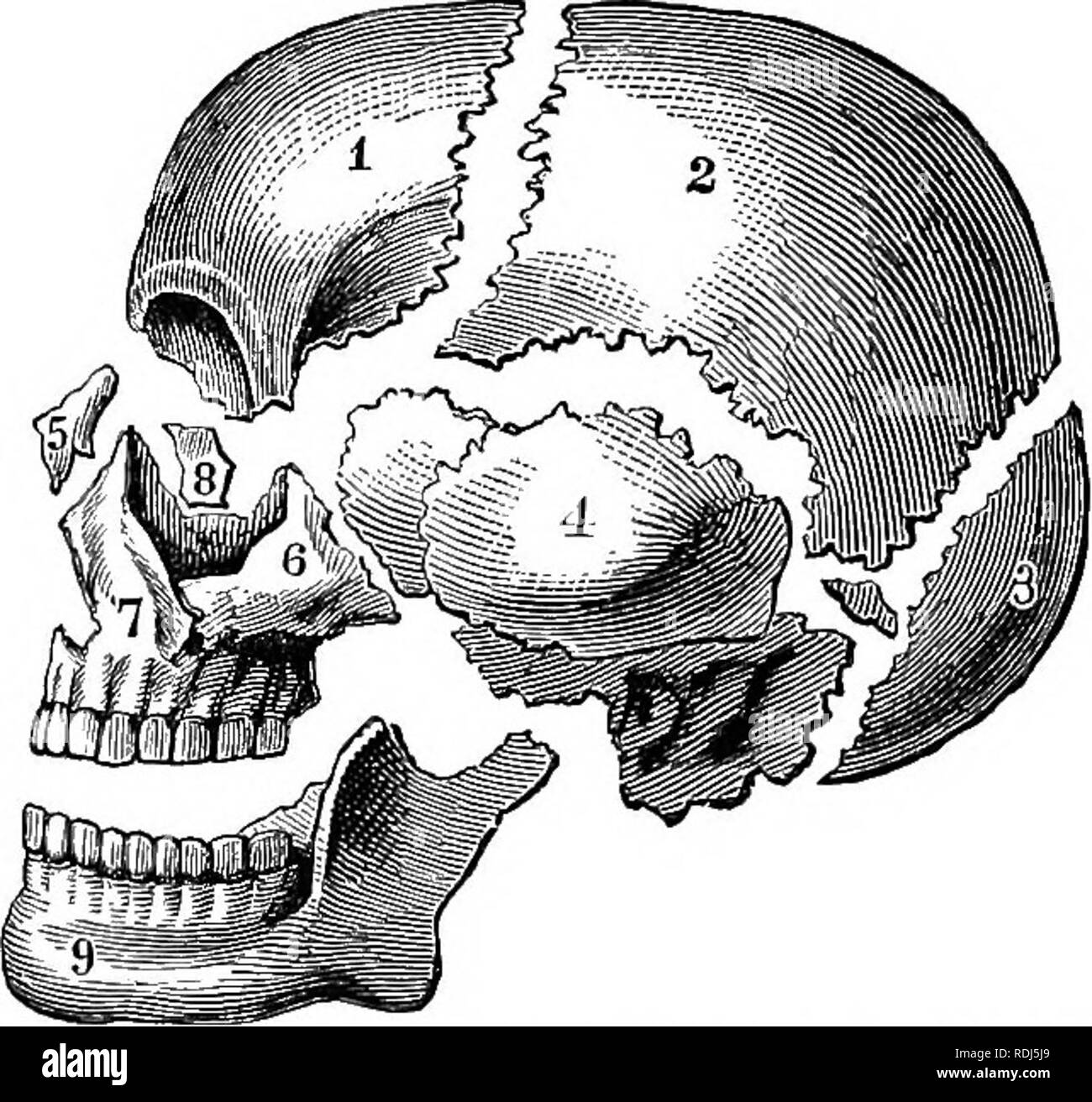 Irregular bones hi-res stock photography and images - Alamy
