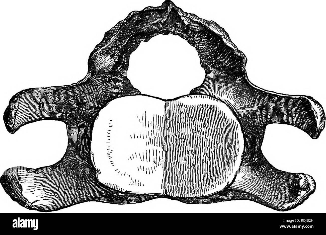 Cervical specimen Black and White Stock Photos & Images - Alamy