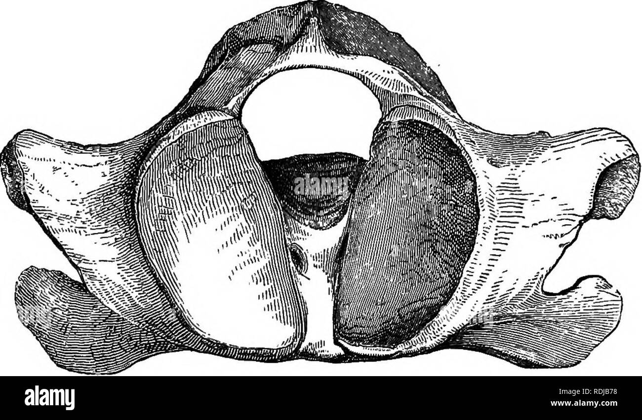 Lateral mass of atlas hi-res stock photography and images - Alamy