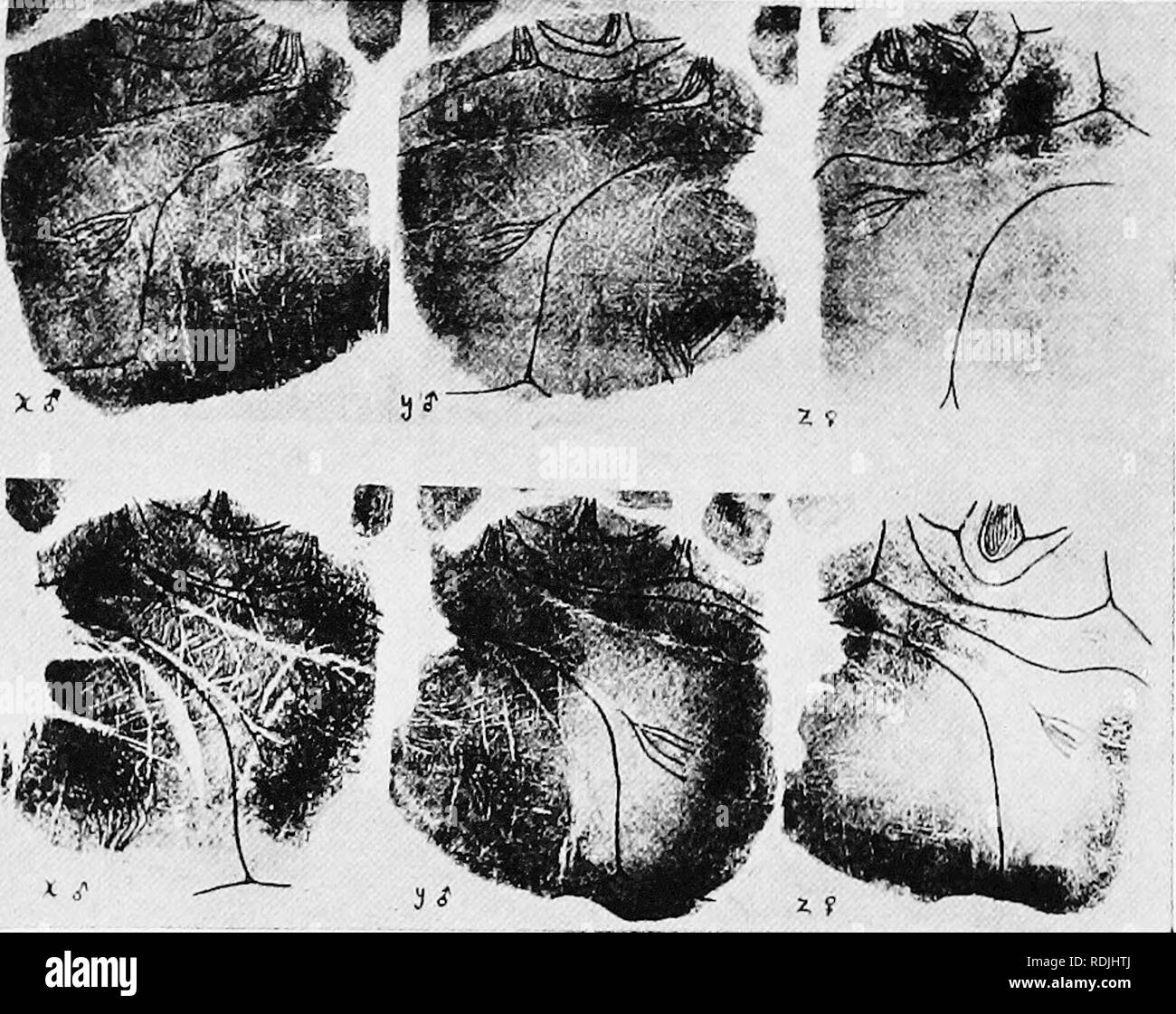 Monozygotic hi-res stock photography and images - Alamy