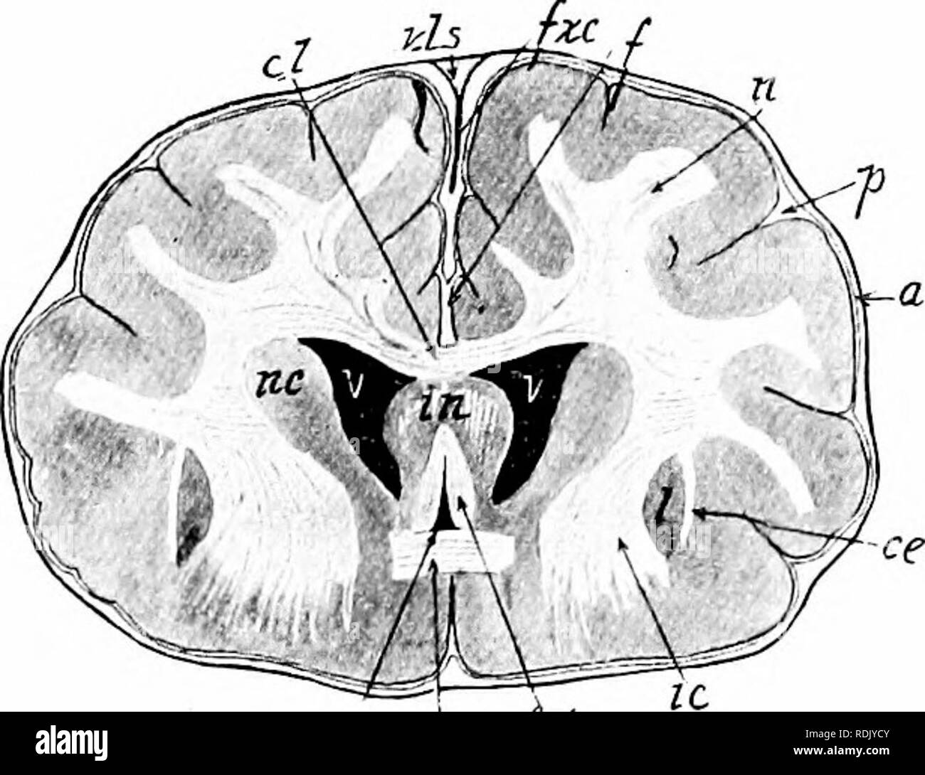 Anterior White Commissure