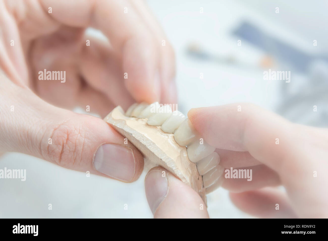 Medical tooth dental technician holding prosthetic in laboratory Stock ...