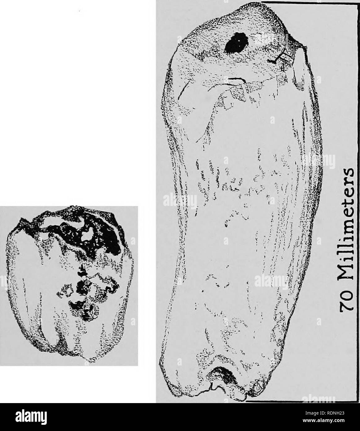 Periostitis Black and White Stock Photos & Images - Alamy