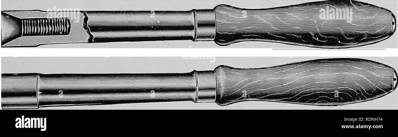 Tooth loos hi-res stock photography and images - Alamy