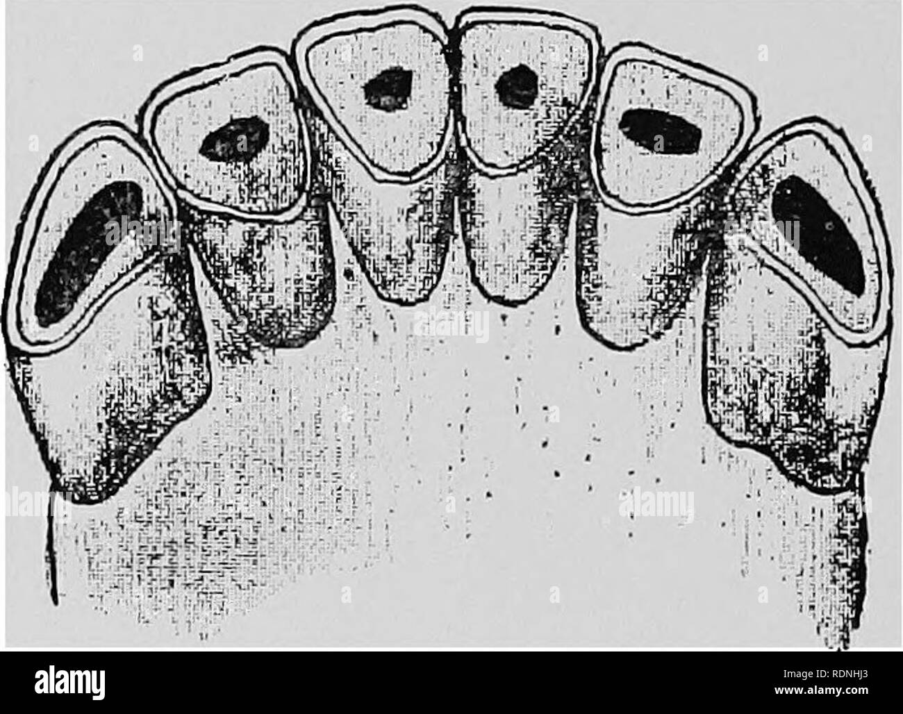 Pathology diag Black and White Stock Photos & Images - Alamy