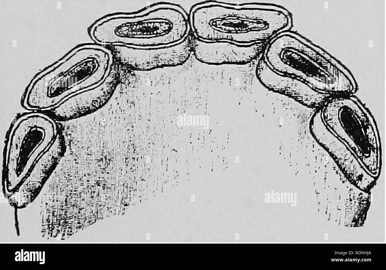 Silver nitrate process hi-res stock photography and images - Alamy