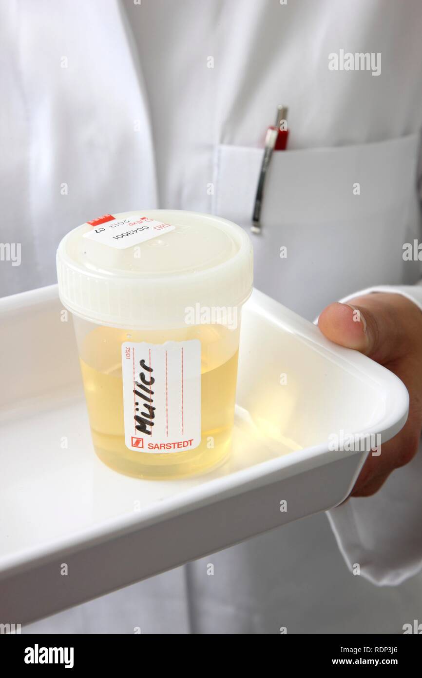 Medical practice, urine sample for analysis in the laboratory Stock ...