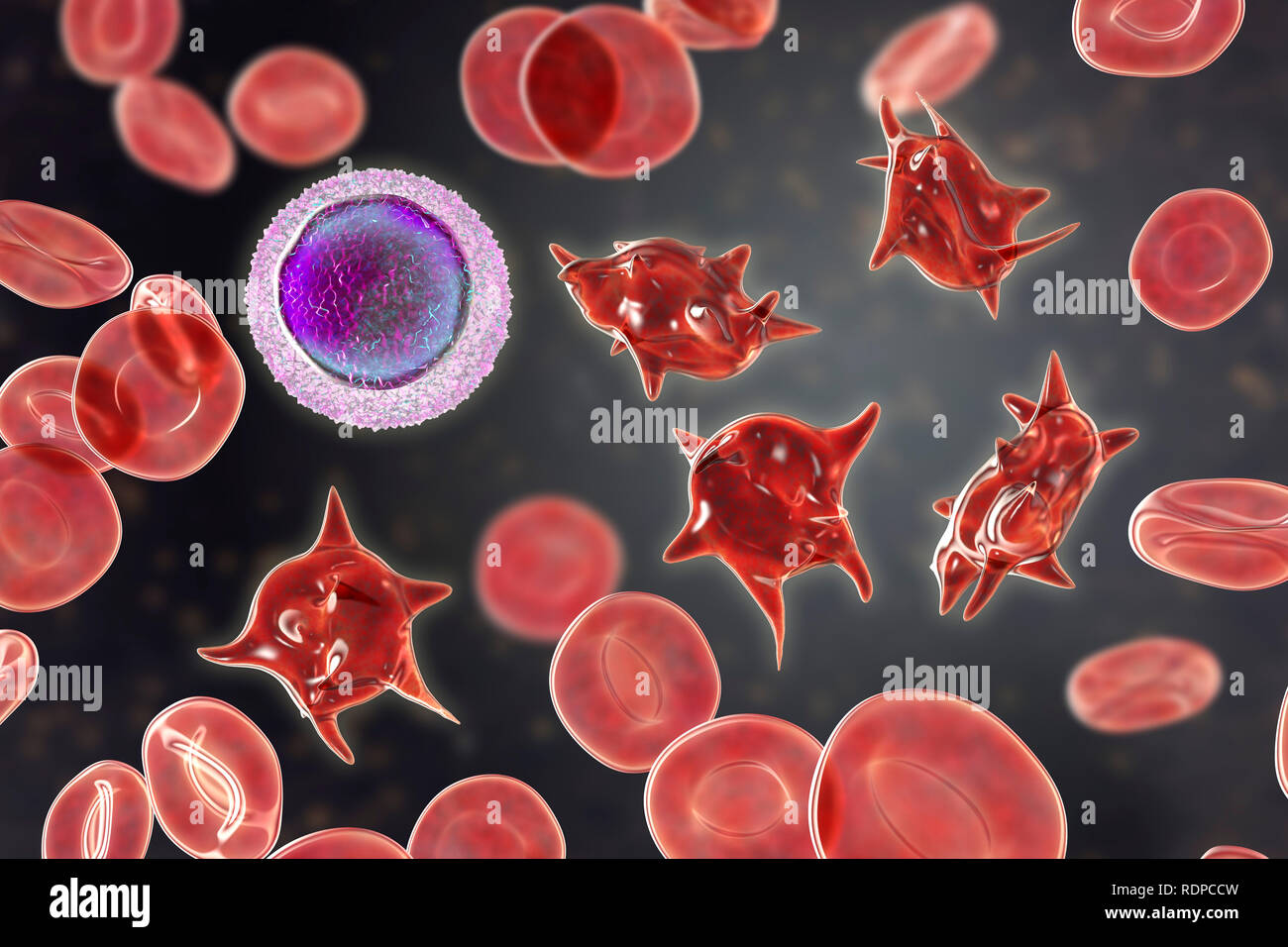 Acanthocytes. Illustration of abnormal red blood cells known as spur ...