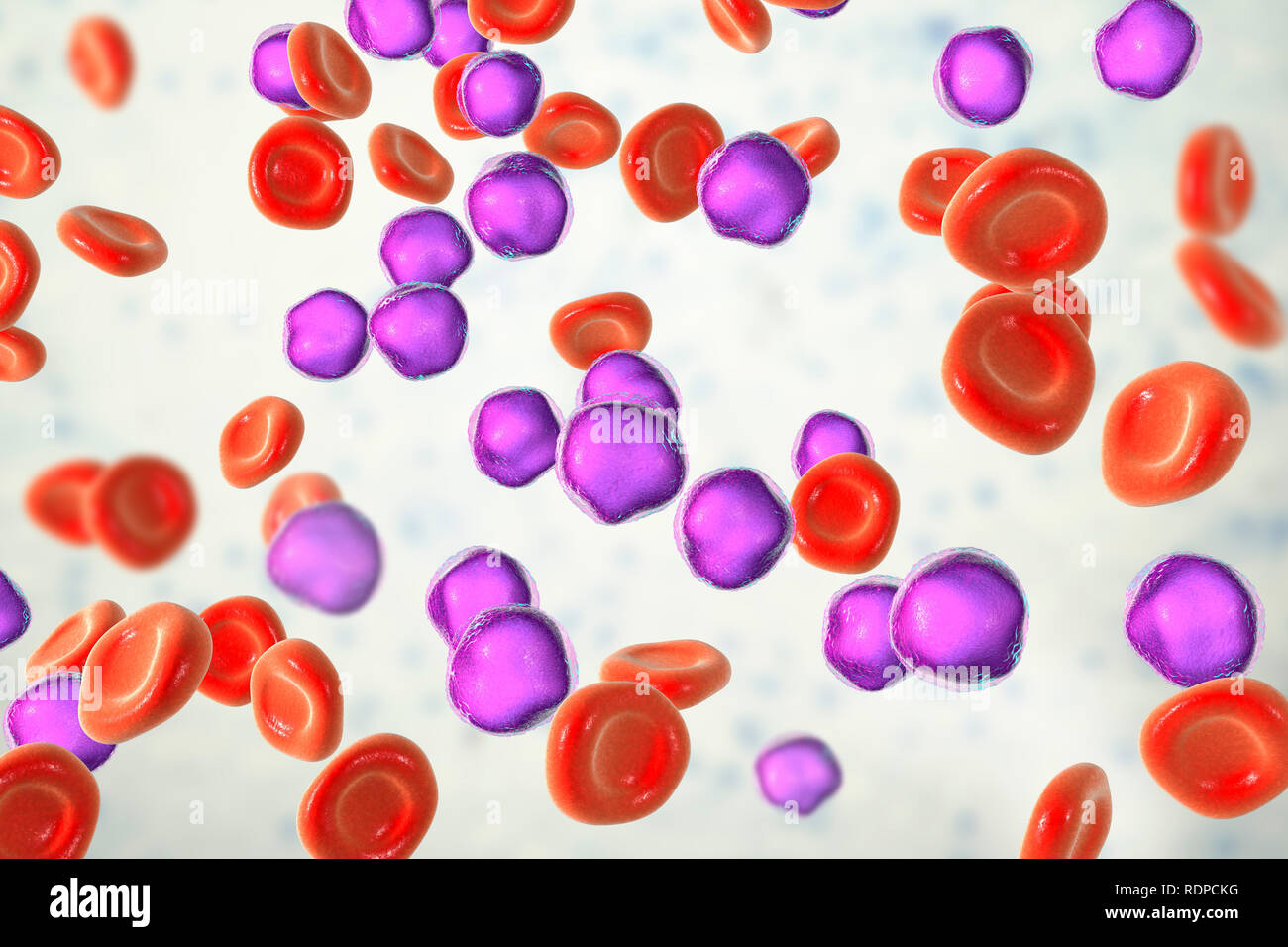 Acute lymphoblastic leukaemia bone marrow smear. Computer illustration ...