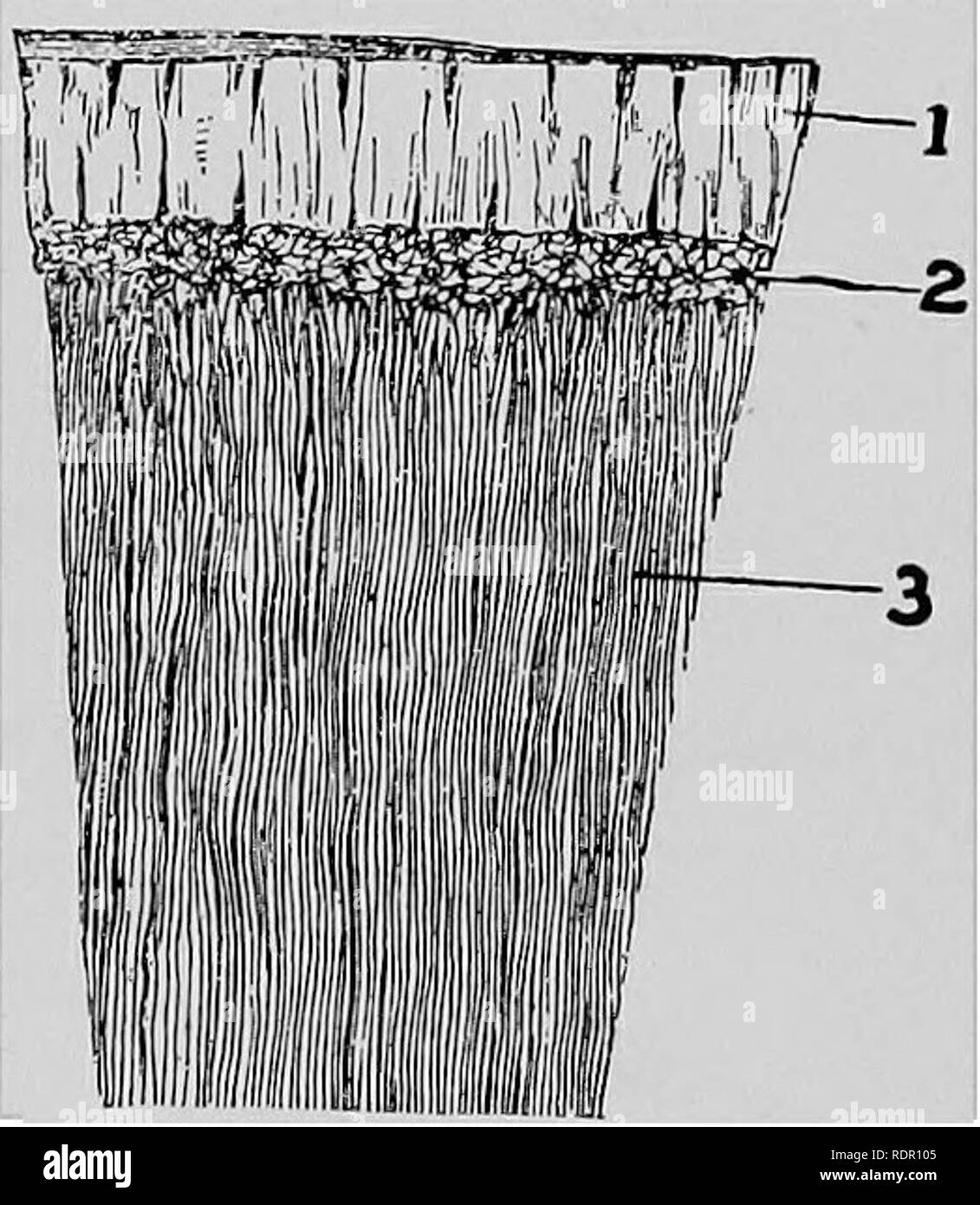Surgery blood pulp Black and White Stock Photos & Images - Alamy