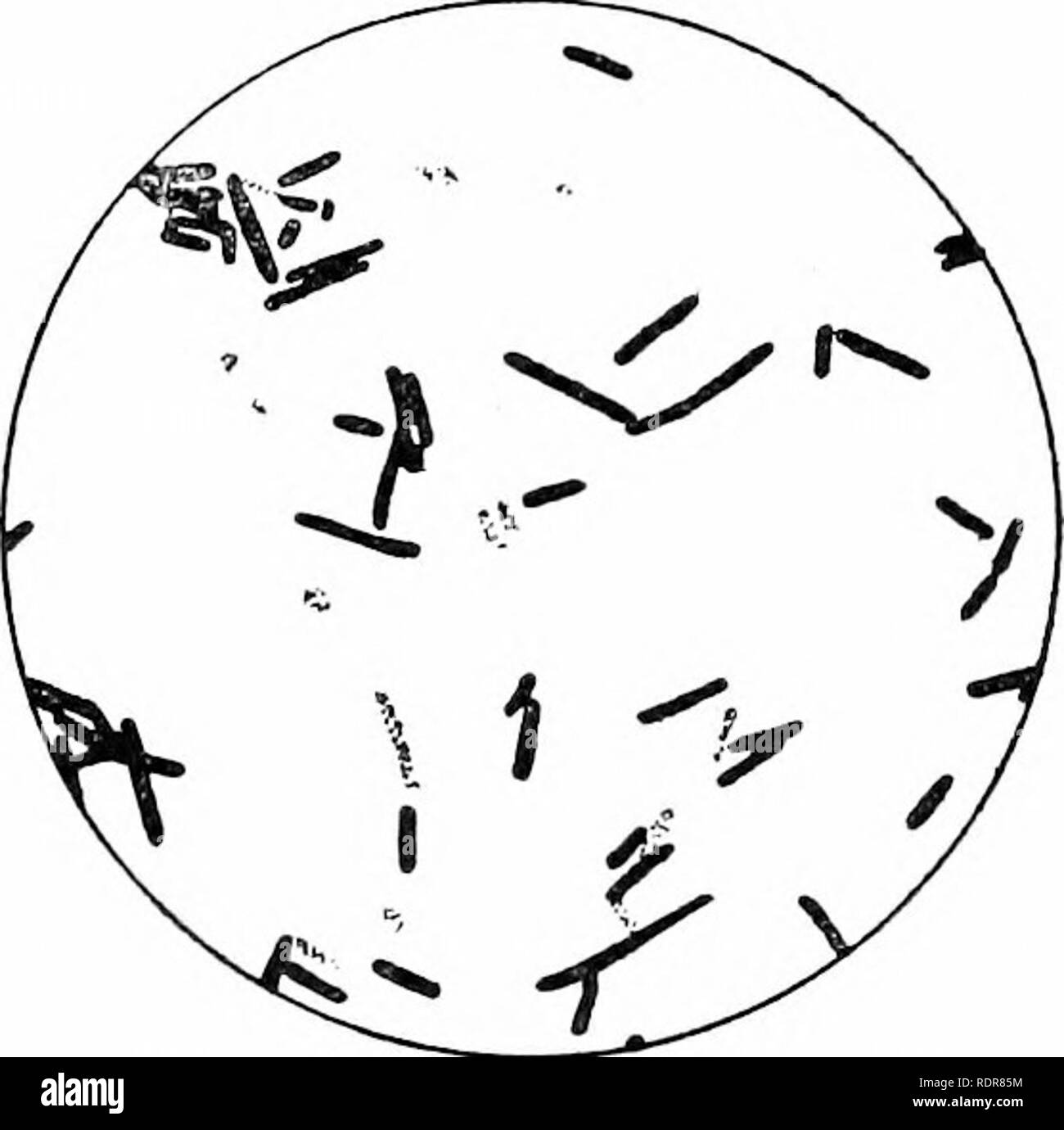 Anaerobic bacteria plate hi-res stock photography and images - Alamy