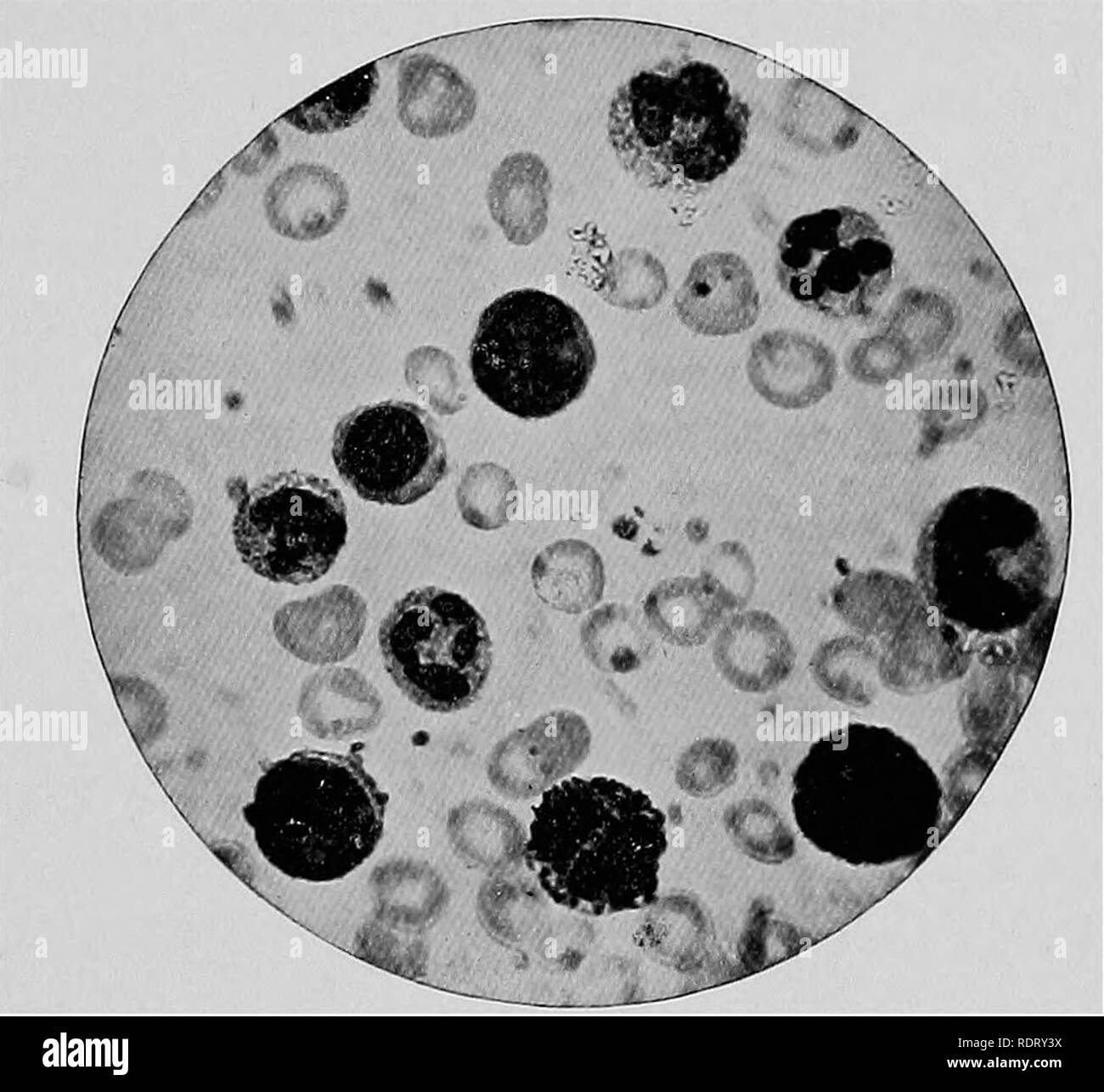 Normal red blood cells microscopy hi-res stock photography and images ...