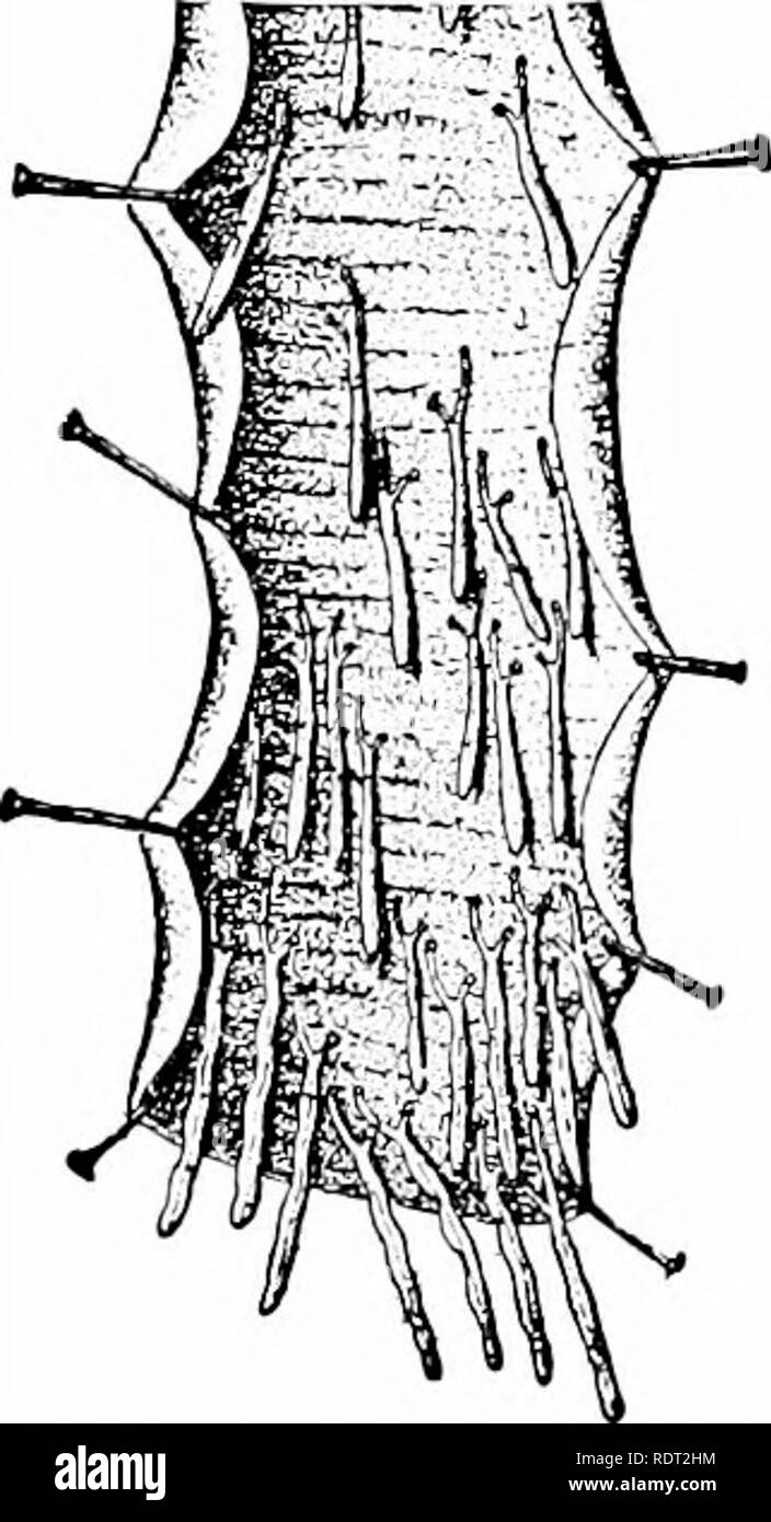 Anemia africa hi-res stock photography and images - Alamy