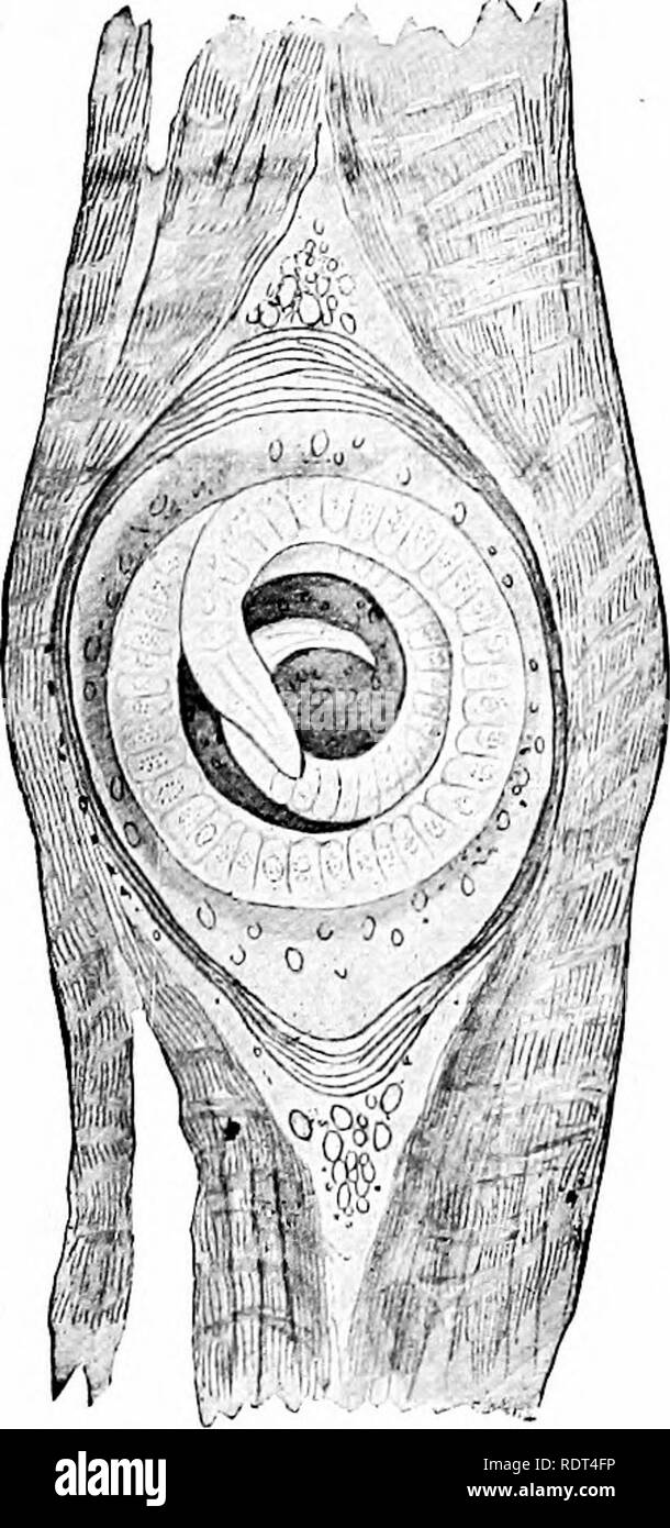 Trichina spiralis hi-res stock photography and images - Alamy