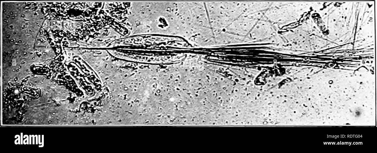 Needle like crystals Black and White Stock Photos & Images - Alamy