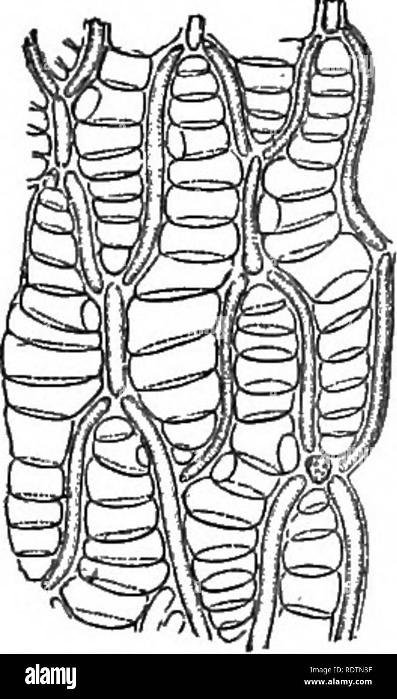 Appendix tissue Black and White Stock Photos & Images - Alamy