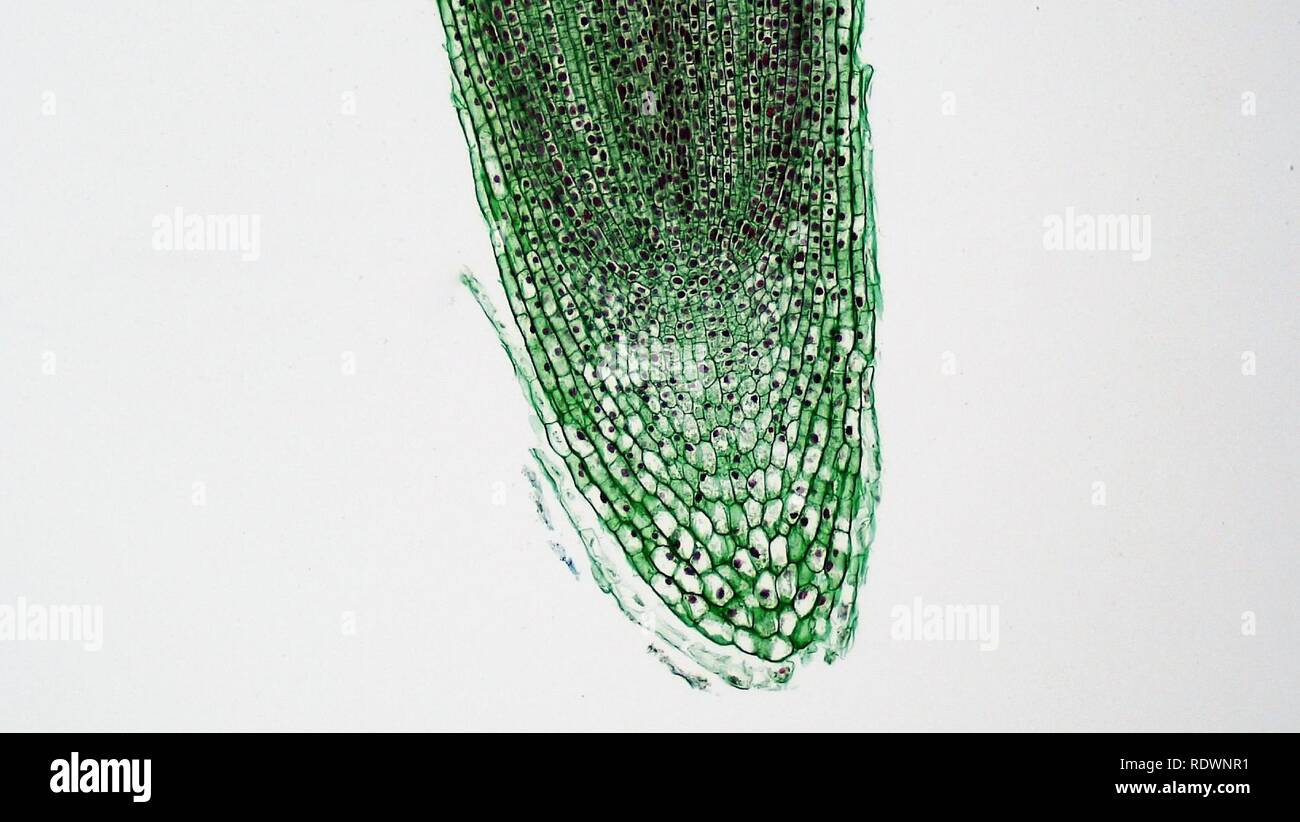 Meristema Apical De La Raíz