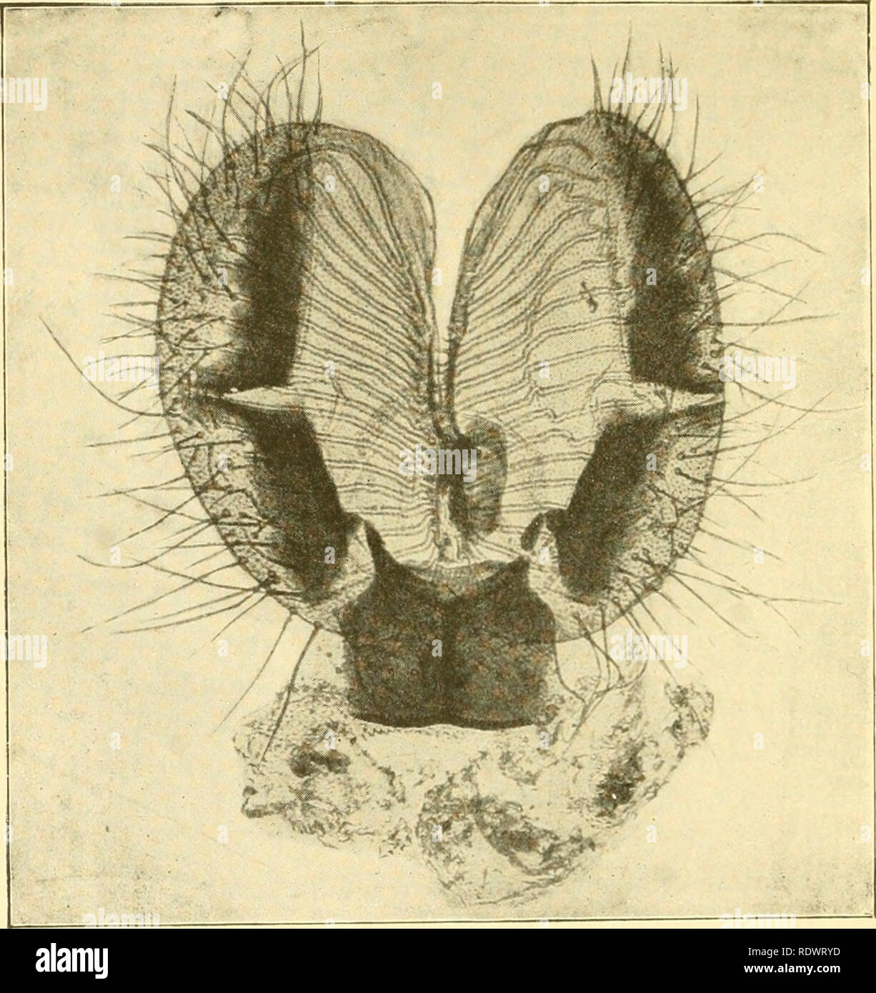 Enlarged lips hi-res stock photography and images - Alamy