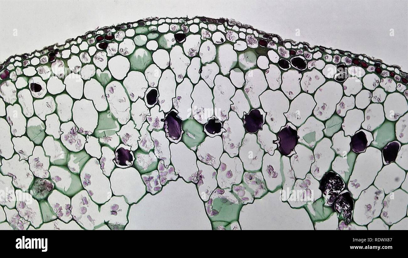 Hypodermis hi-res stock photography and images - Alamy