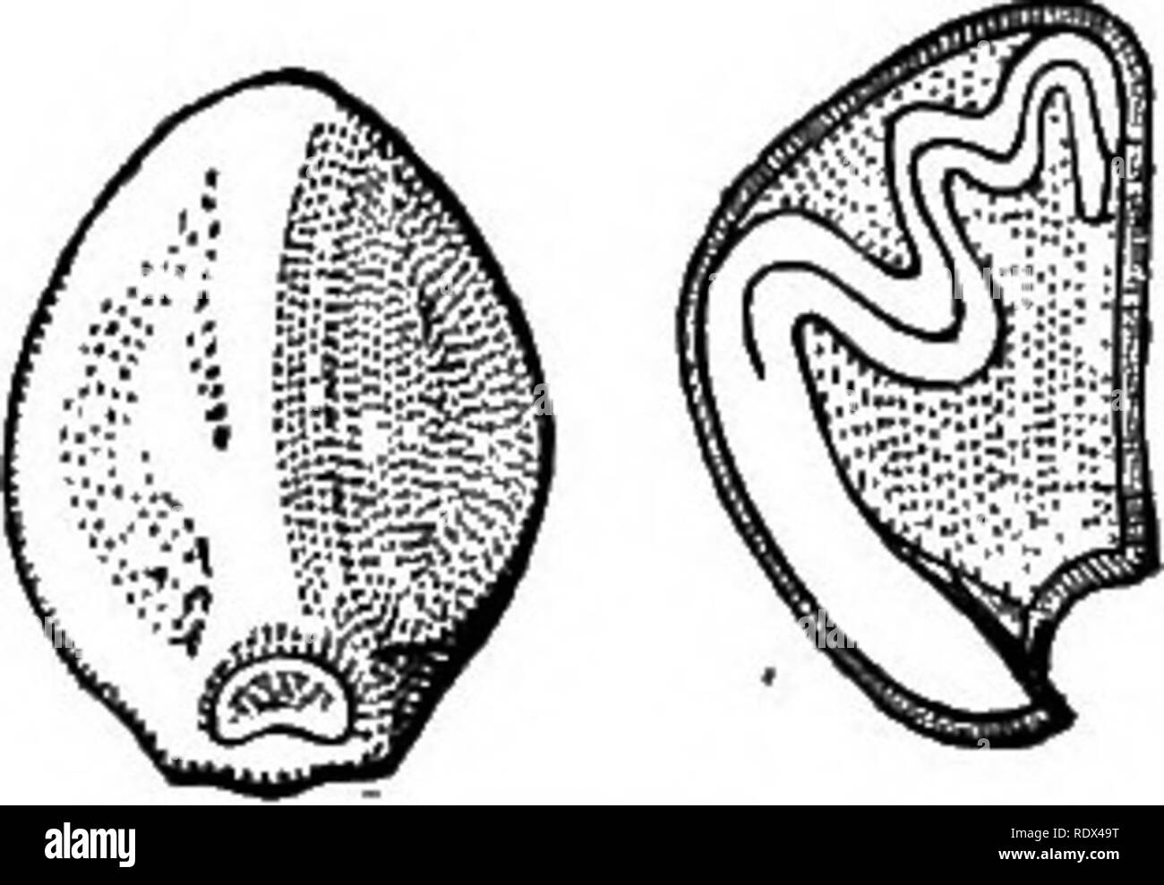 Appendix diagram Black and White Stock Photos & Images - Alamy