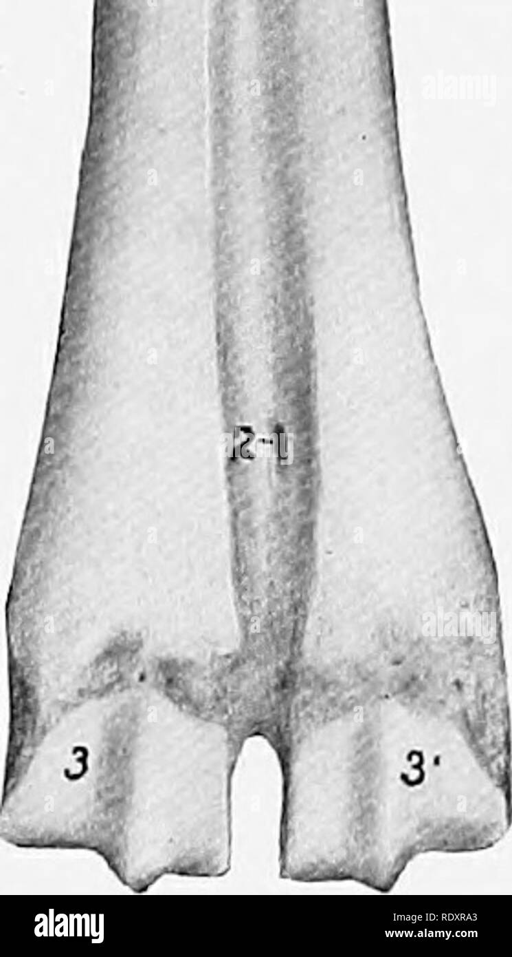 Humerus Bone Anatomy Attachments And Side Determination