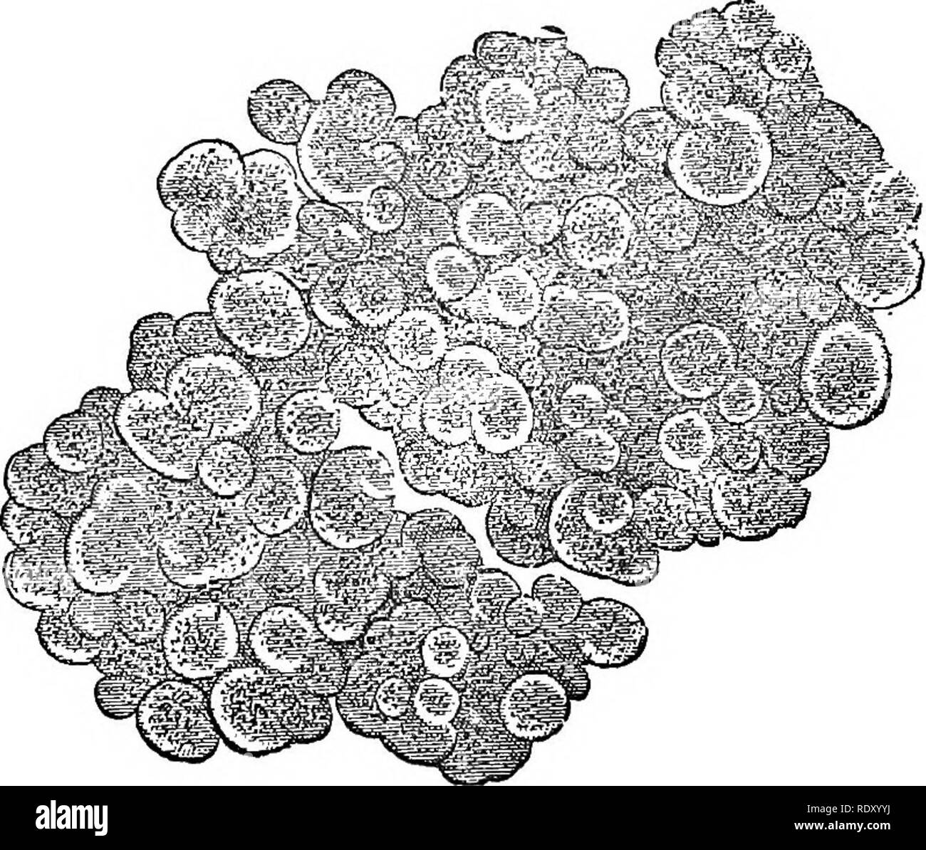 Pus wound Black and White Stock Photos & Images - Alamy