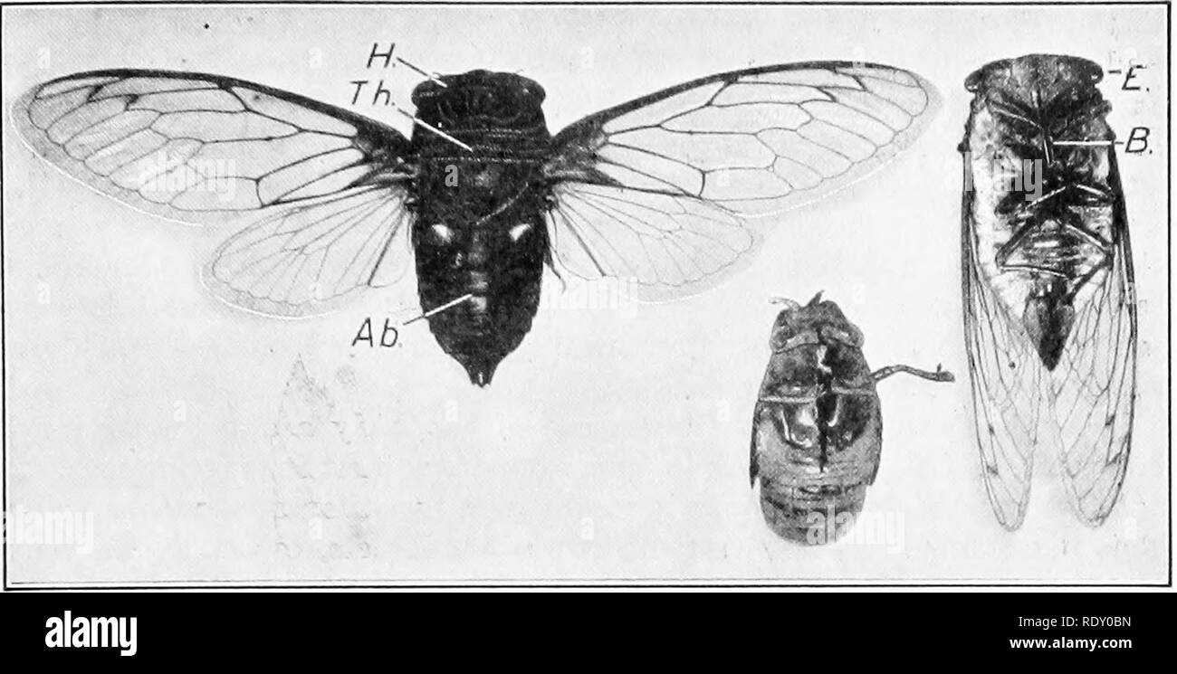 Thorax in anterior view hi-res stock photography and images - Alamy