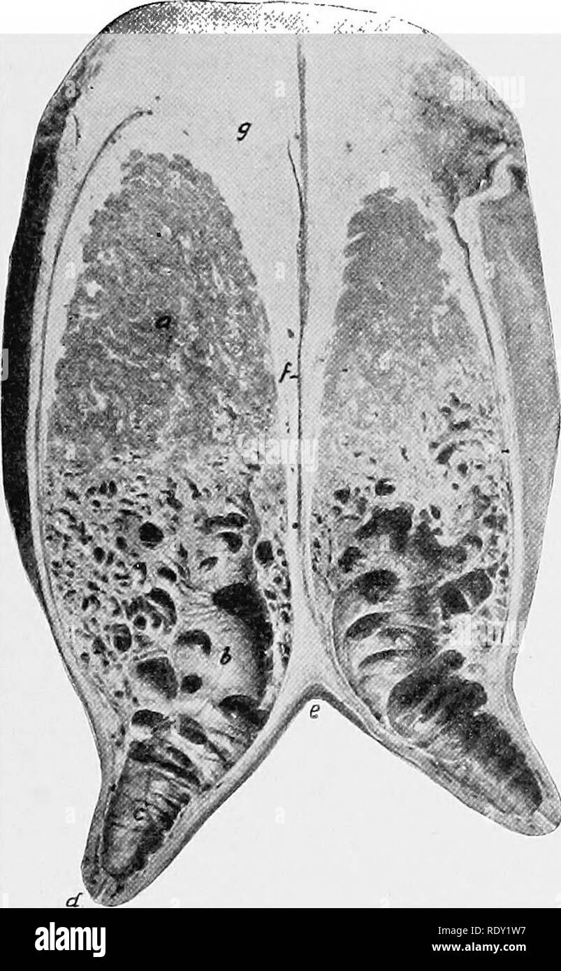 Cross section uterus Black and White Stock Photos & Images - Alamy