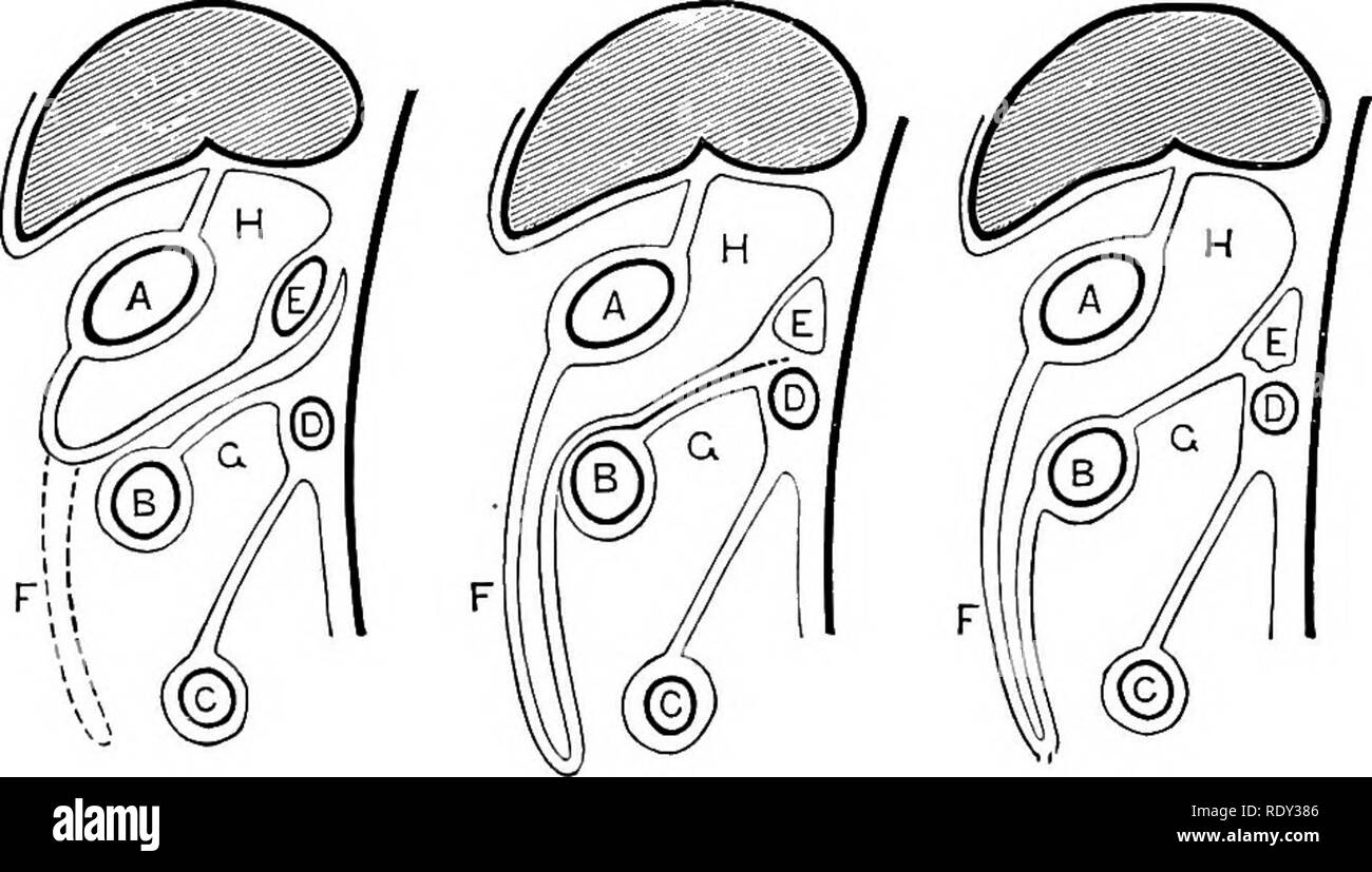 Greater omentum hi-res stock photography and images - Alamy