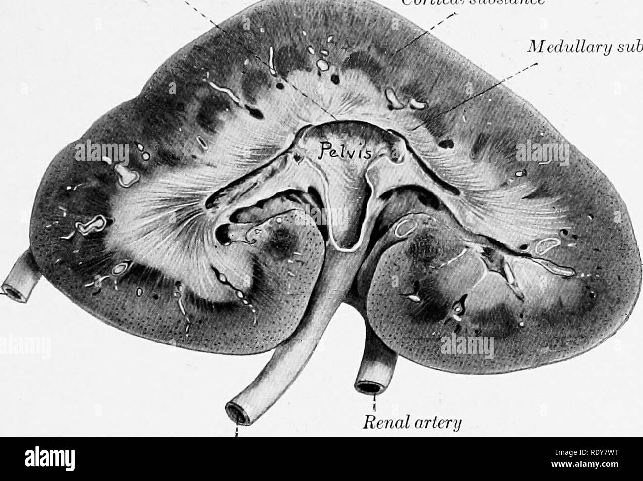 Left kidney spleen Black and White Stock Photos & Images - Alamy