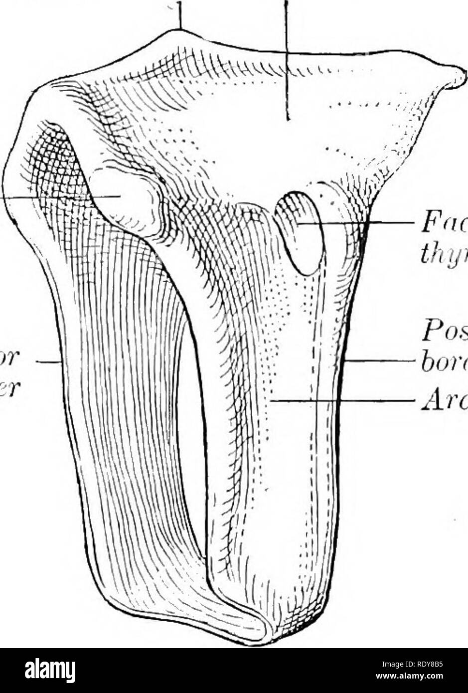 Thyroid Notch