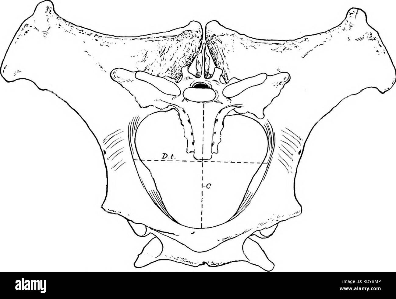 Pelvic Inlet View