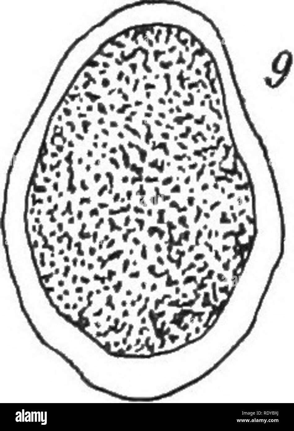 Starch granules potato tuber cells Black and White Stock Photos ...