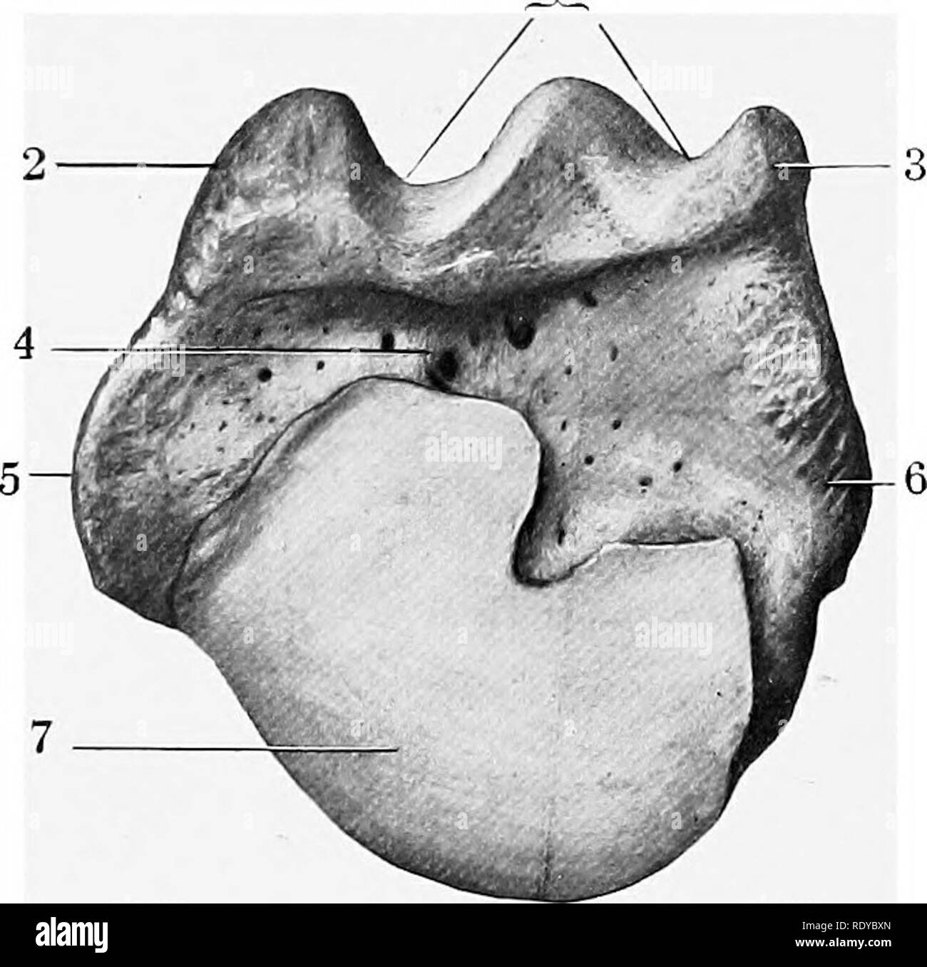 Coronoid fossa hi-res stock photography and images - Alamy