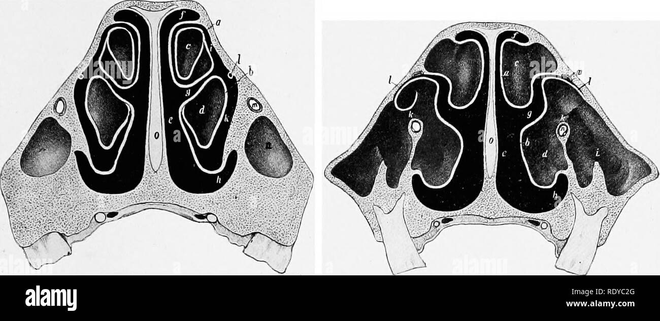 Nasal turbinate bone hi-res stock photography and images - Alamy